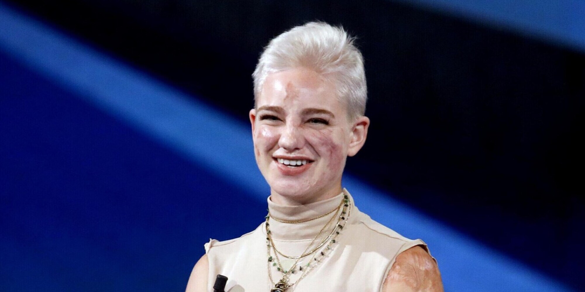 Bebe Vio si sposa? Lui è un calciatore. Perché c'entra Totti