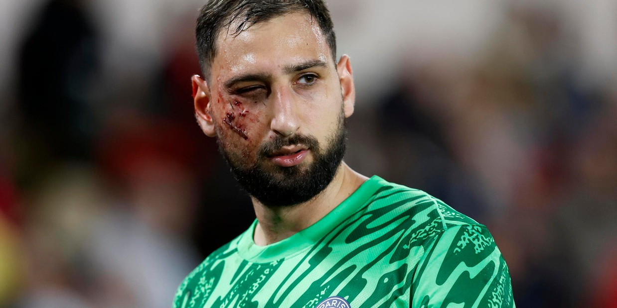 Psg, 'Donnarumma trauma facciale con ferite multiple'